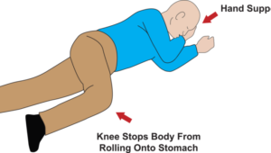 Cardiopulmonary Resuscitation (CPR): A simple life saving measure that ...