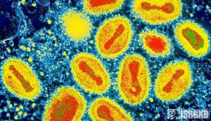 Top 10 Most Deadliest Viruses in Human History Across the Globe